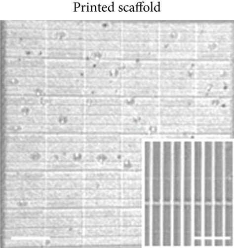 Human Induced Pluripotent Stem Cell Derived Cardiac Muscle Patch Hcmp