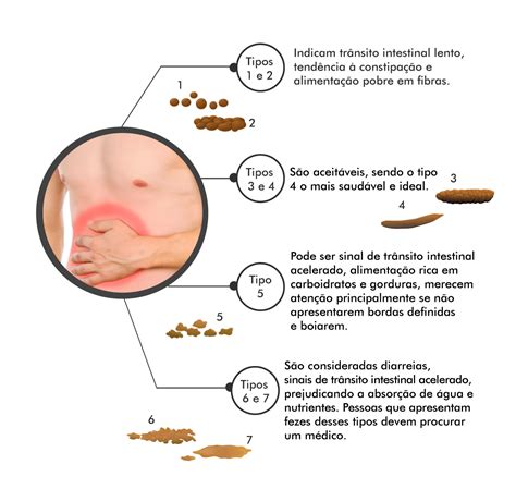 O que os tipos de fezes podem dizer sobre sua saúde Clínica Gástrica