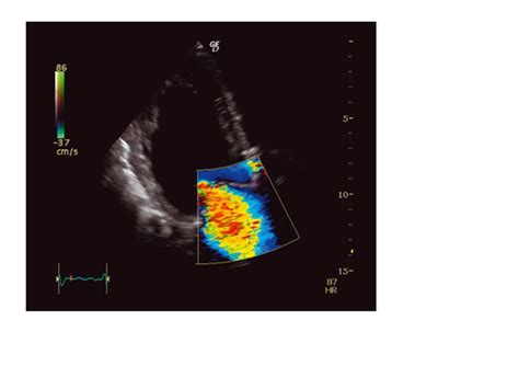 Week 5 Flashcards Quizlet Week 5 Flashcards Quizlet