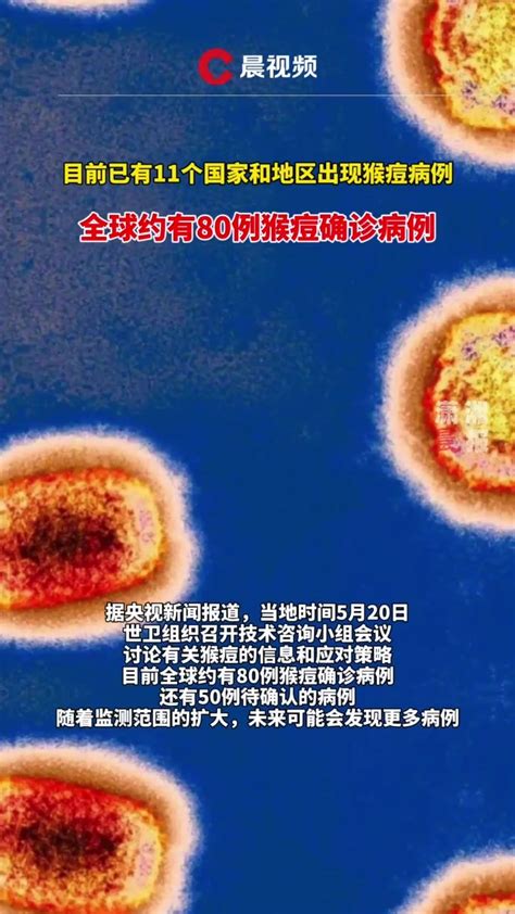 世卫组织：目前全球约有80例猴痘确诊病例凤凰网视频凤凰网