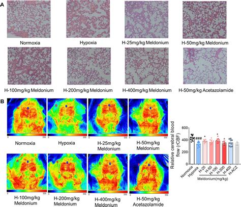 Frontiers Insights Into The Pharmacodynamics And Pharmacokinetics Of