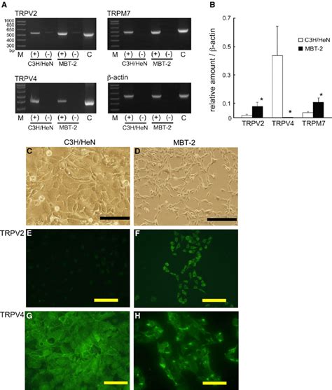Expression Of Trpv2 Trpv4 And Trpm7 In Primary Urothelial Cells From