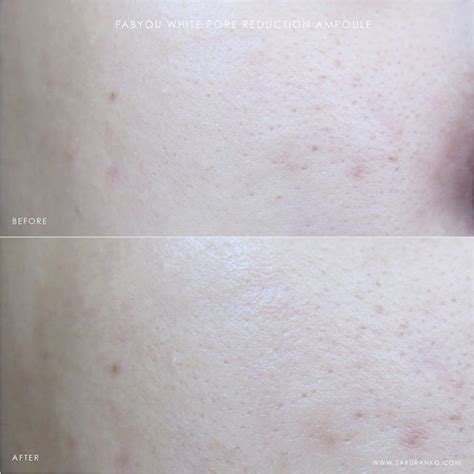 Sakuranko: FABYOU White Pore Reduction Ampoule