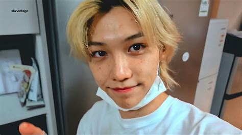 Felix Freckles из архива фотки для всех в интернете