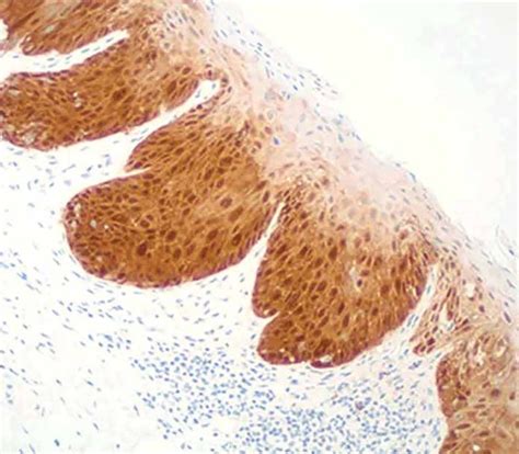 What Are The Different Detection Methods For Ihc Enzo