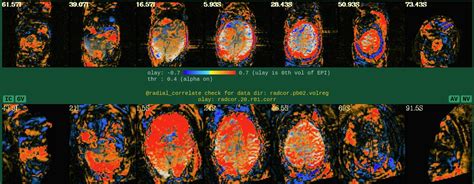 Uisng Fsl And Afni To Do Epi Bias Field Correction Software Support Neurostars