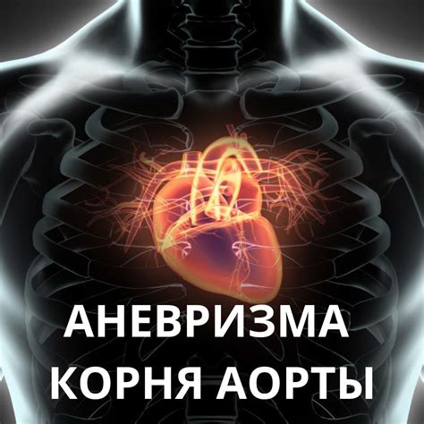 Лечение в Германии Израиле и Южной Корее в Linkedin кардиология