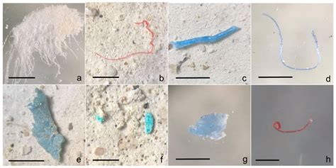 Disentangling Microplastic Pollution On Beach Sand Of Puerto Princesa Palawan Island