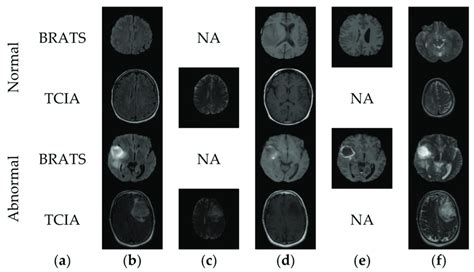 Sample Test Images With Varied Modalities A Dataset Employed B