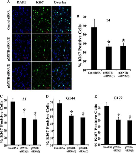 Down Regulation Of P75ntr Decreases Brain Tumor Initiating Cell