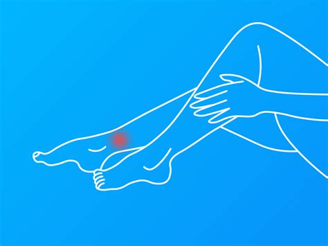 Трофическая язва Причины диагностика лечение
