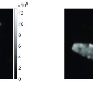 Single Slice Images Of A A 3D OSEM Reconstruction B A BSREM