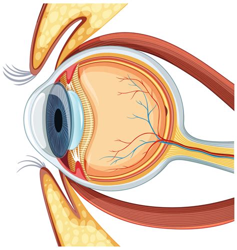 Retinal Detachment Sudden Flashes Of Light Floaters And A Curtain