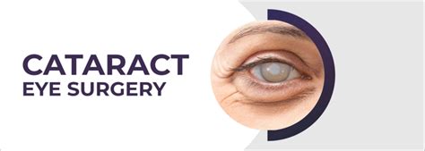 Understanding Cataracts And Modern Treatment Options