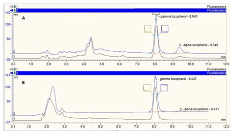 Example Of Chromatogram A The Upper Part Of The Figure Represents