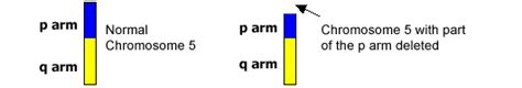 Structural Abnormalities Deletions Cri Du Chat And Duplications