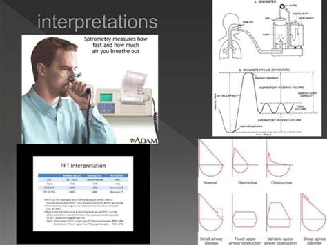 Preanesthetic Evaluation Pptx