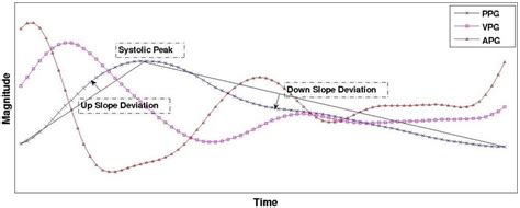 PPG Waveform And Its Derivatives Download Scientific Diagram