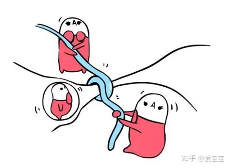 女性结扎以后还能做试管怀孕吗 知乎