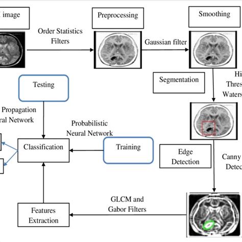 Brain Tumor Detection Based On Pnn Training Process With Bpnn Download Scientific Diagram