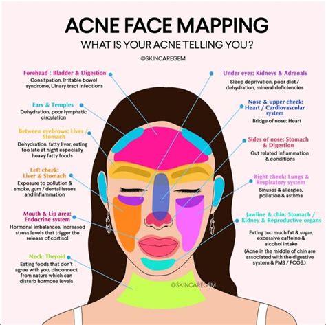 The Acne Face Map Clear Skin Through Acne Face Mapping Artofit