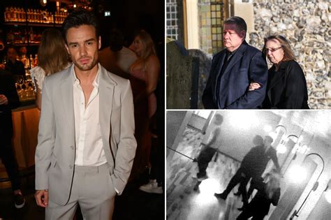 Exclusive Cosmetic Surgery Experts On Liam Paynes Shocking New Look