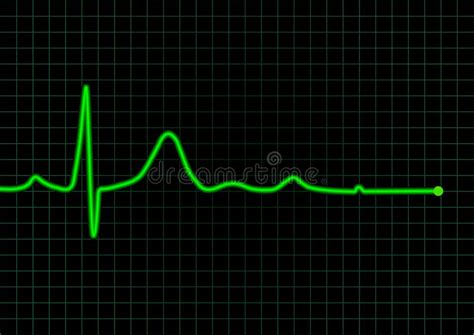 Diagnosis Ekg Stock Illustrations 8851 Diagnosis Ekg Stock