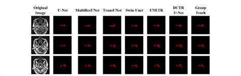 Visualization And Qualitative Comparison Results Under Mainstream