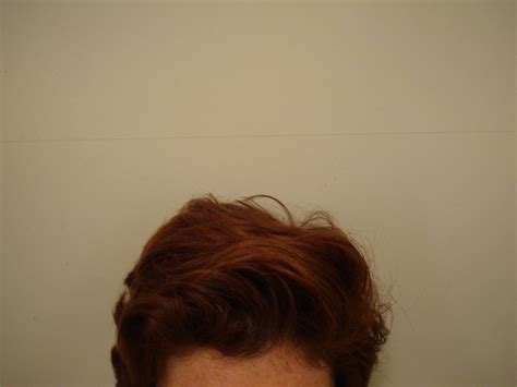 Chemo Chic Chemo Curls