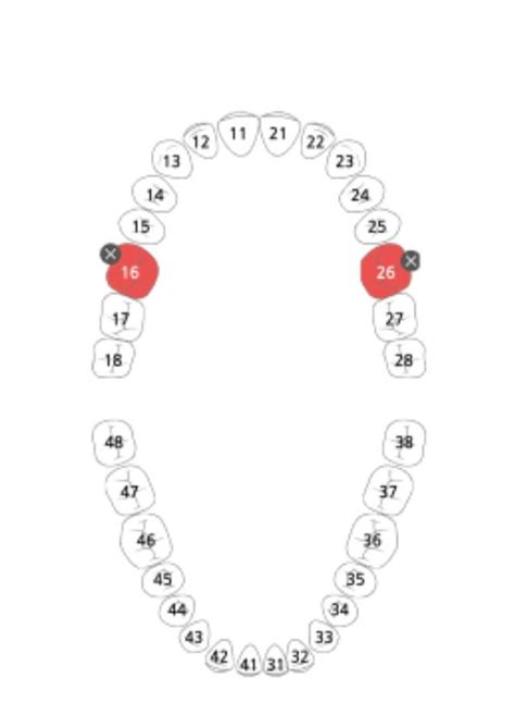 Retrieving Strings And Images From Cloudkit Rswift