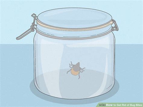 Ways To Get Rid Of Bug Bites WikiHow