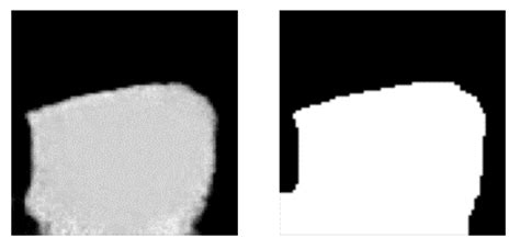 A Two Stage Deep Generative Model For Masked Face Synthesis
