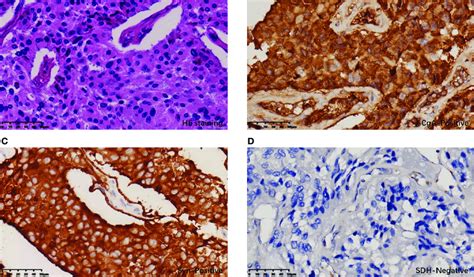 Histopathological And Immunohistochemical Results Of Pgl A The Cells