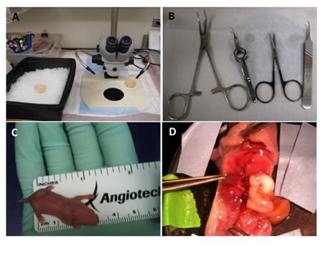 Video Isolation Of Neonatal Extrahepatic Cholangiocytes