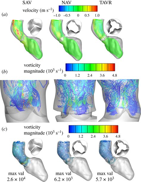 Model Predictions Of Flow Dynamics In Ascending Aorta Near End Systole Download Scientific