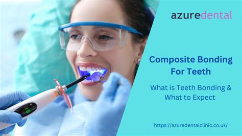 Composite Bonding For Teeth What Is Teeth Bonding And What To Expect