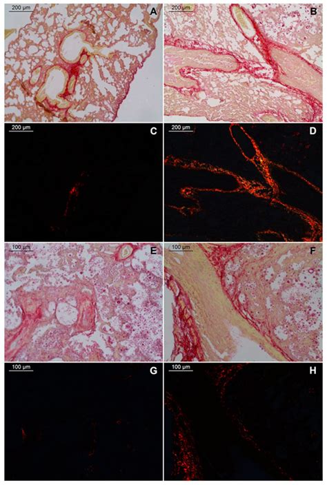 Pathogens Mdpi On Linkedin Pulmonary Cryptococcus Cryptococcosis