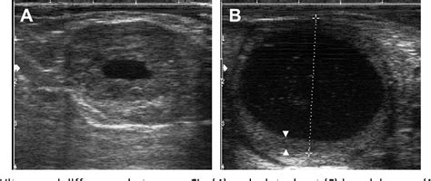 Ultrasonography Of The Bovine Female Genital Tract Semantic Scholar