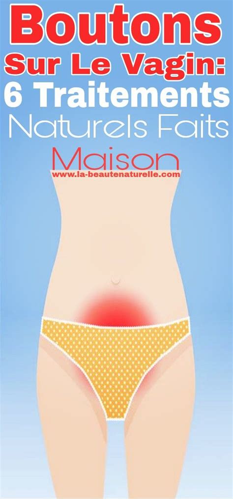 Pin on santé vaginale