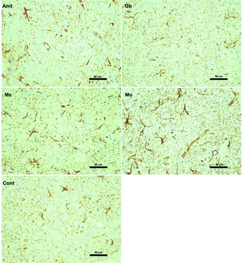 Astrocytic Immunostaining For Gfap In The Core Region Of The Nac Of