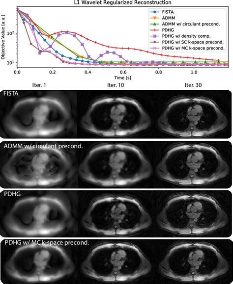 Figure 4 From Accelerating Non Cartesian Mri Reconstruction Convergence Using K Space