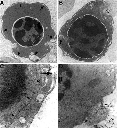 Ultrastructural Characteristics Of Orthochromatic Erythroblasts A