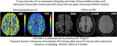 Patient Selection Using Doac Monitoring — Enable Ivt If Doac Levels Are Download Scientific