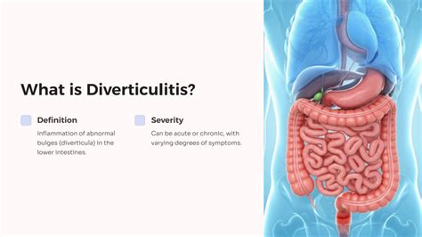 Diverticulitis Va Rating All Veteran