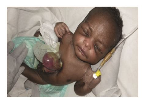 Ectopia Cordis Photograph From Above Download Scientific Diagram