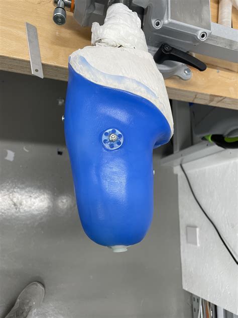 Prothetik Lösungen Kosow Prothetik Steinfurt