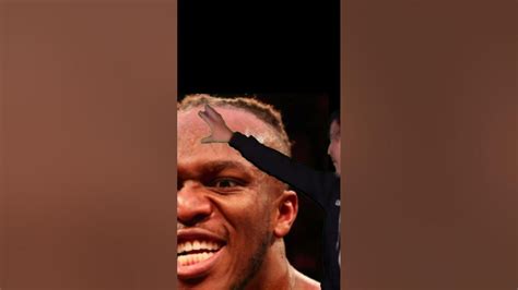 Ksi Forehead Is So Big Youtube