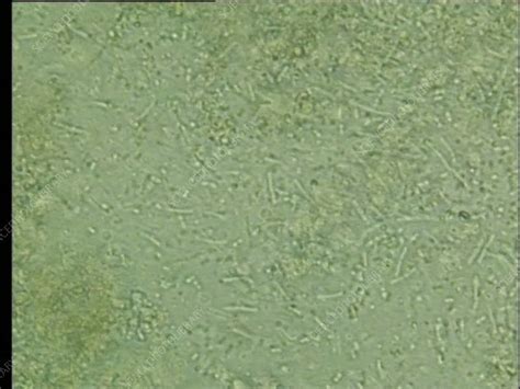 Staphylococcus Bacteria Microscopy Stock Video Clip K009 2653 Science Photo Library