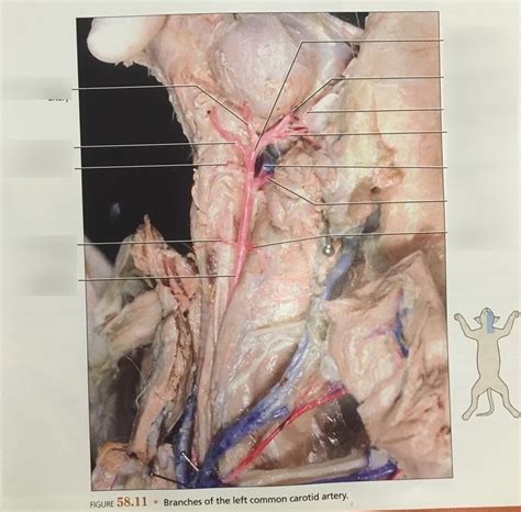 Cva Lab Circulatory Cat Figure 58 11 Diagram Quizlet