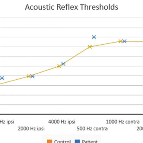 Acoustic Reflex Thresholds Of Groups In The Patient Group The 500 Hz Download Scientific